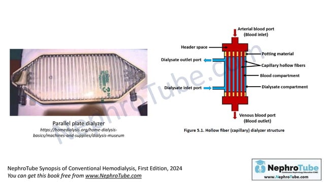 Hemodialysis: Chapter 5, Dialyzers Overview - Dr.Gawad | PDF ...