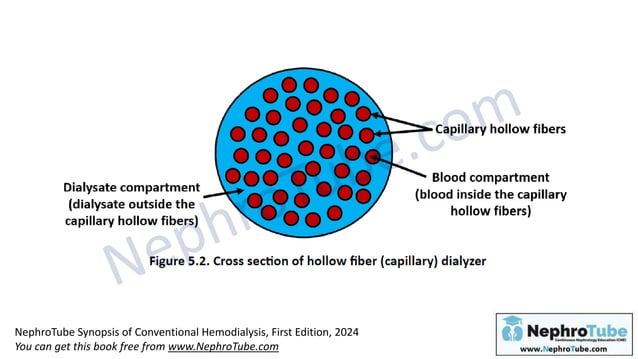 Hemodialysis: Chapter 5, Dialyzers Overview - Dr.Gawad | PDF ...