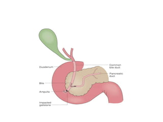Chapter 5 Gall Bladder Diseases power point | PPT