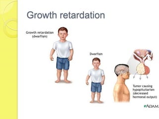 Form 3 Science Chapter 5 Growth | PPTX