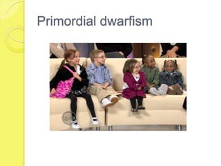 Primordial Dwarfism Finn