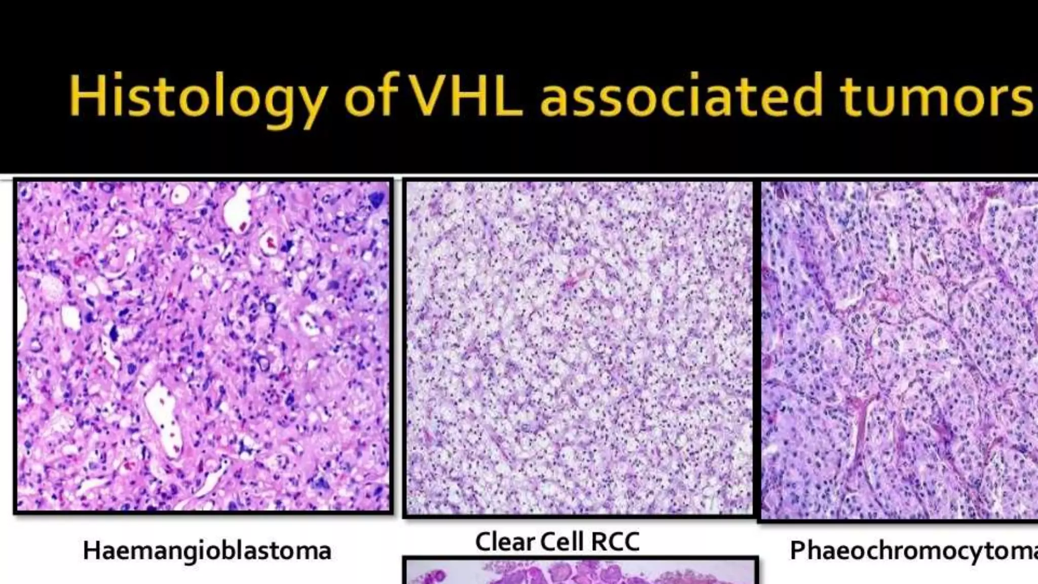 Chapter 5 hereditary cancer syndrome extra slides | PPT