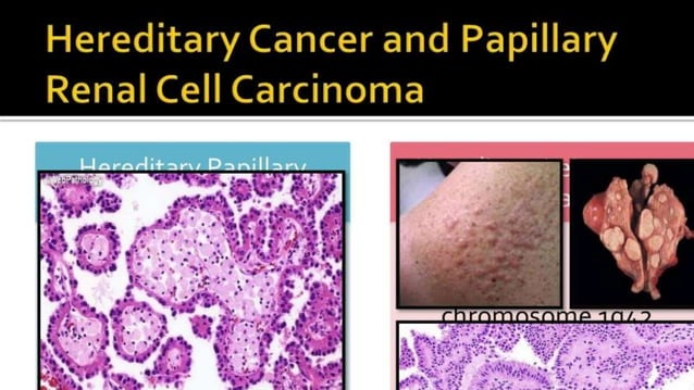 Chapter 5 hereditary cancer syndrome extra slides | PPTX