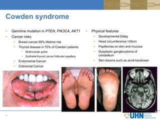 Chapter 5 hereditary cancer syndrome next generation | PPTX