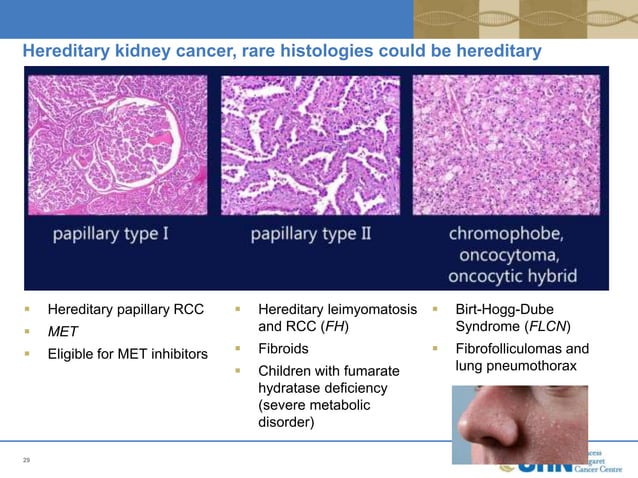 Chapter 5 hereditary cancer syndrome next generation | PPTX