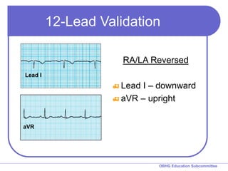 Chapter 5 - Making Sense of the 12 Lead | PPT