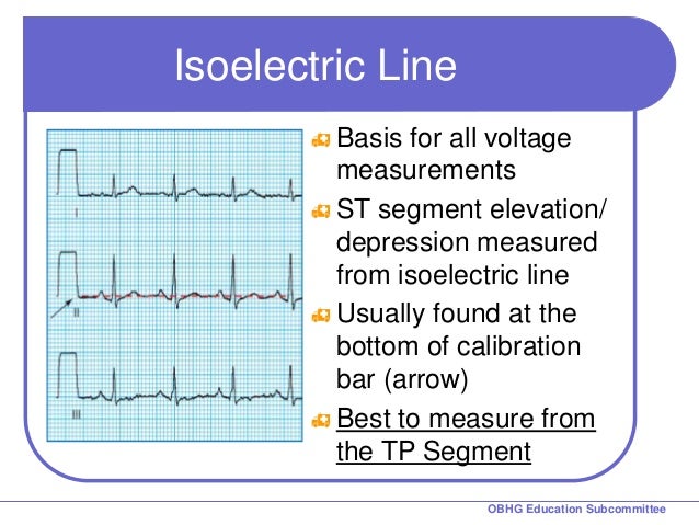 Chapter 5 - Making Sense of the 12 Lead