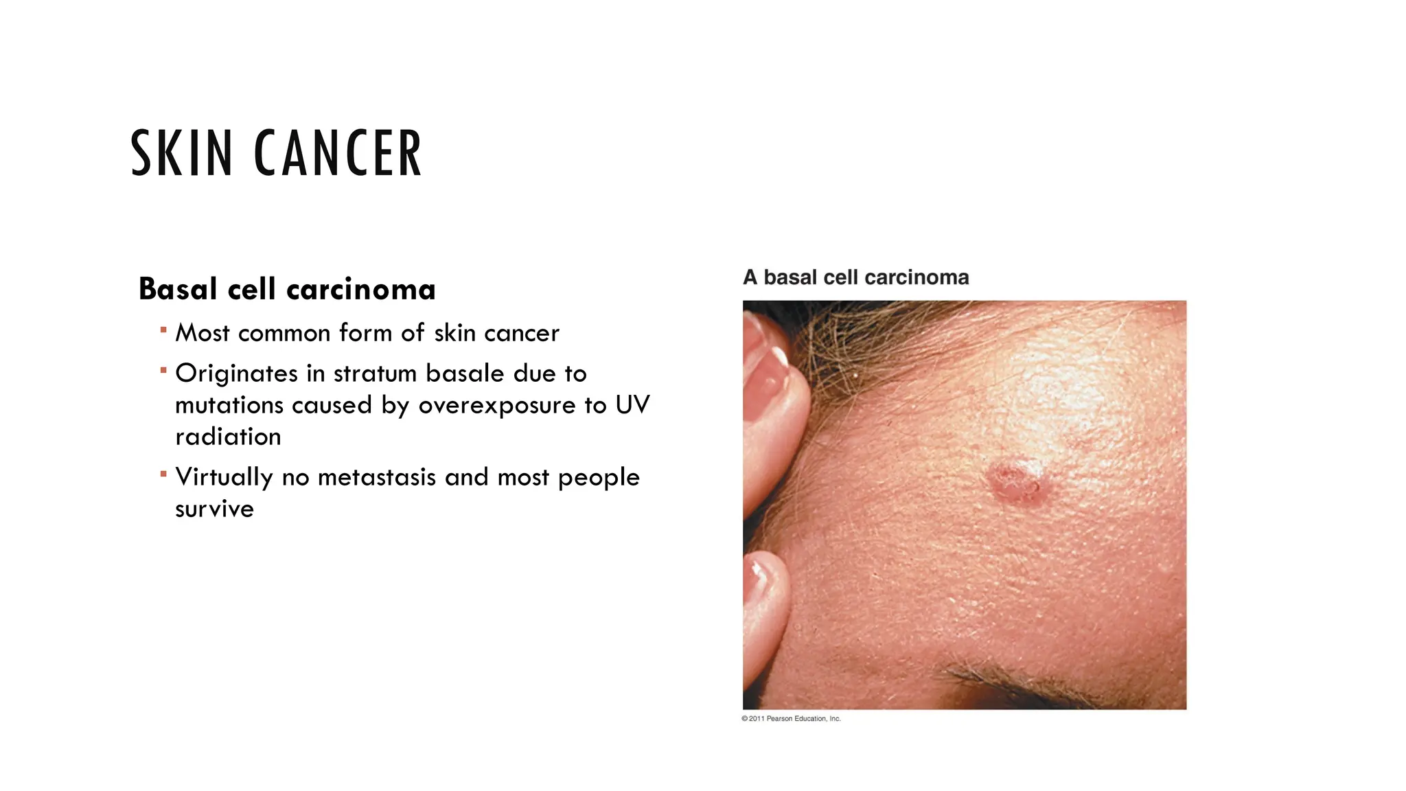 BIO 168 Anatomy & Physiology Integumentary System | PPT