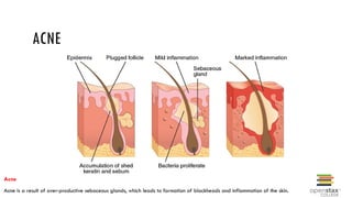 BIO 168 Anatomy & Physiology Integumentary System | PPTX