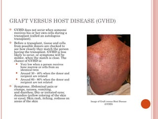 Chapter 6 - Lymphatic and Immune System | PPT