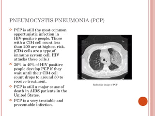 Chapter 6 - Lymphatic and Immune System | PPT