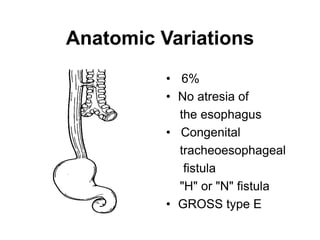 chapter 6-1 Esophageal atresia and TEF.ppt