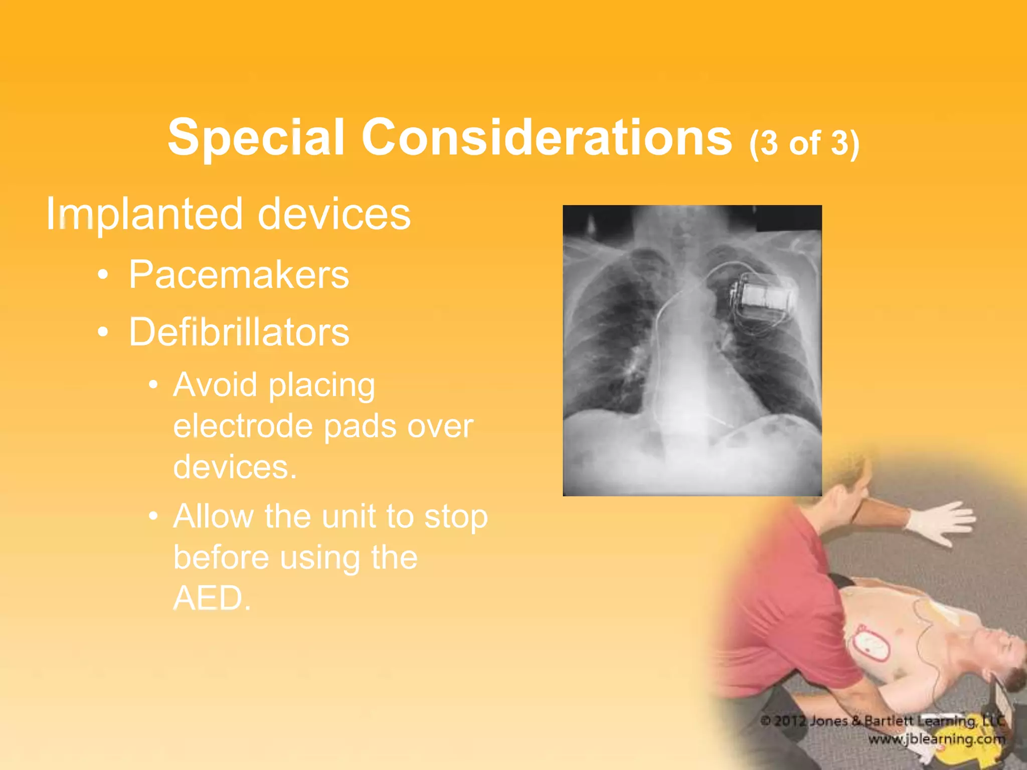 Chapter 6 Automated External Defibrillation | PPTX