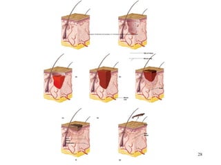 Chapter 6 integumentary system | PPT