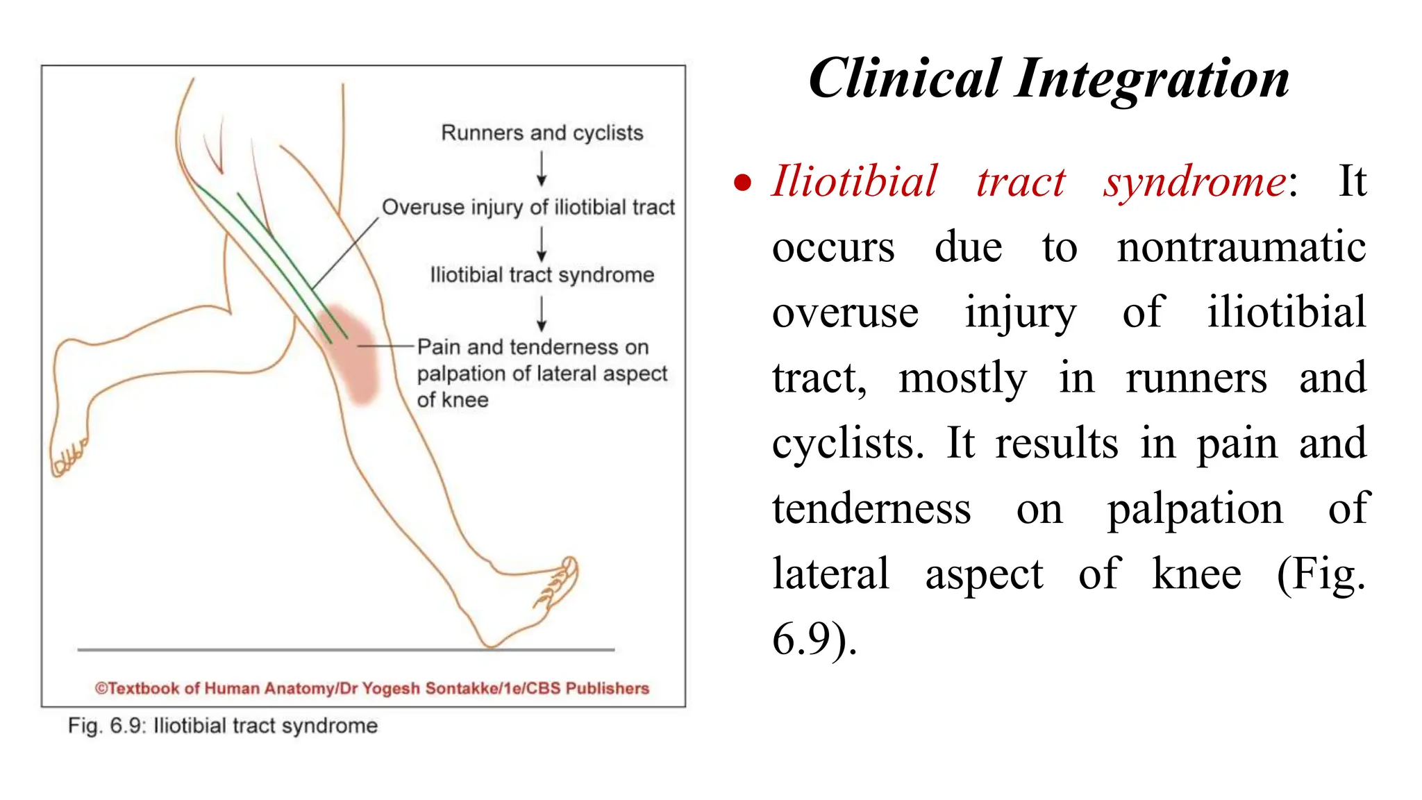 Chapter 6 Front of the thigh I Fascia and Muscles.pptx