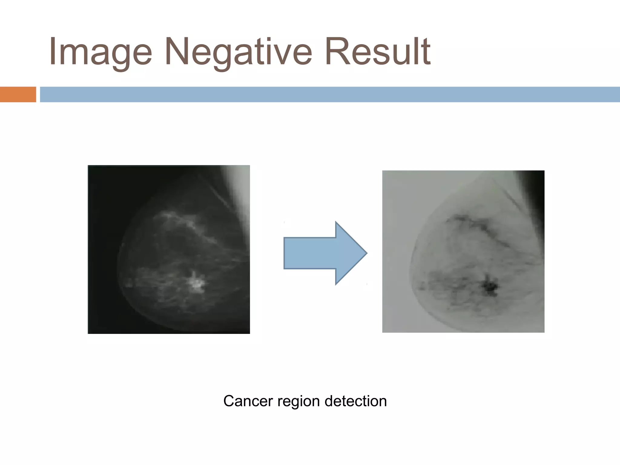 Chapter 6 Image Processing: Image Enhancement | PPT