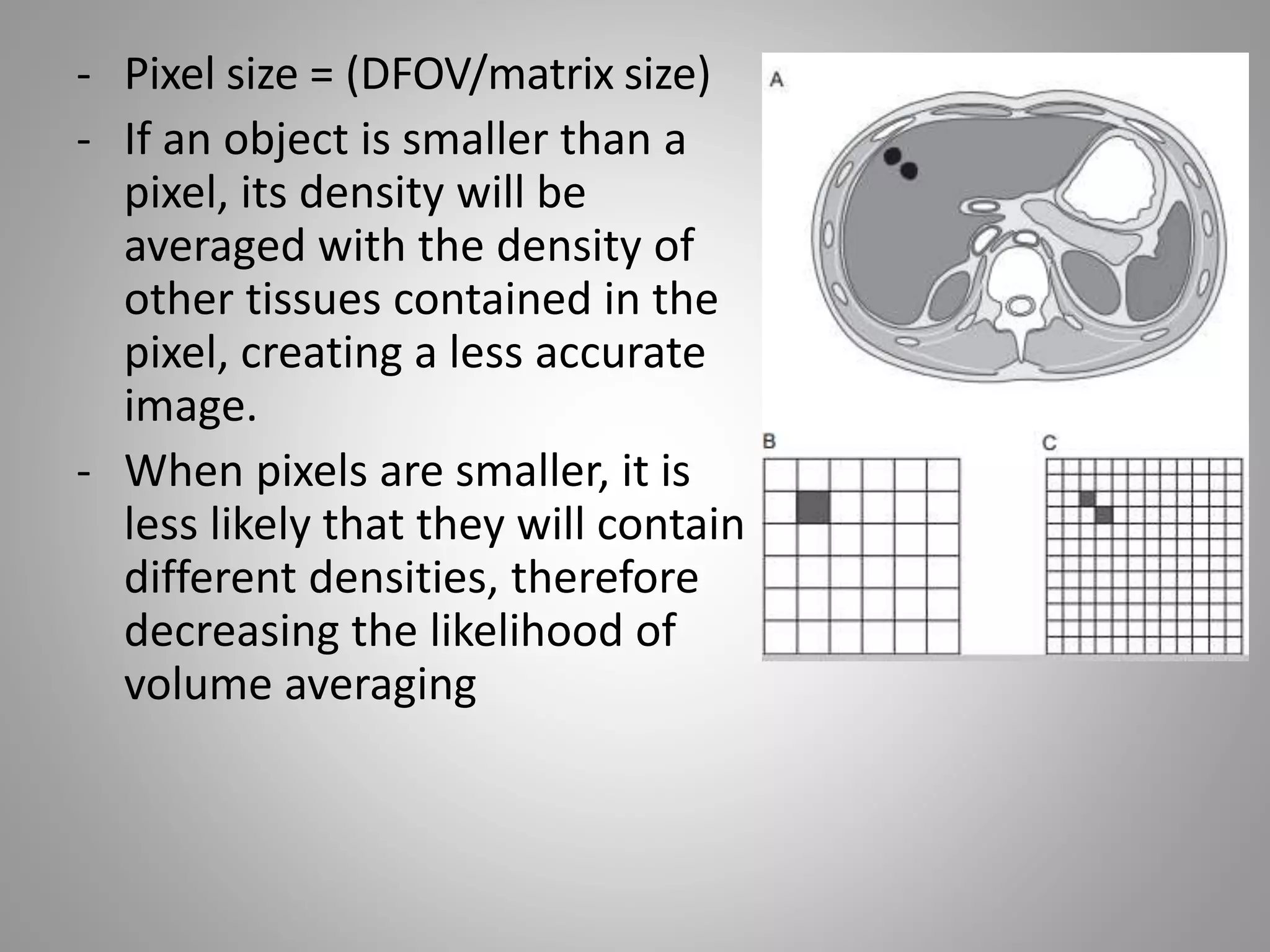 Chapter 6 image quality in ct | PPTX