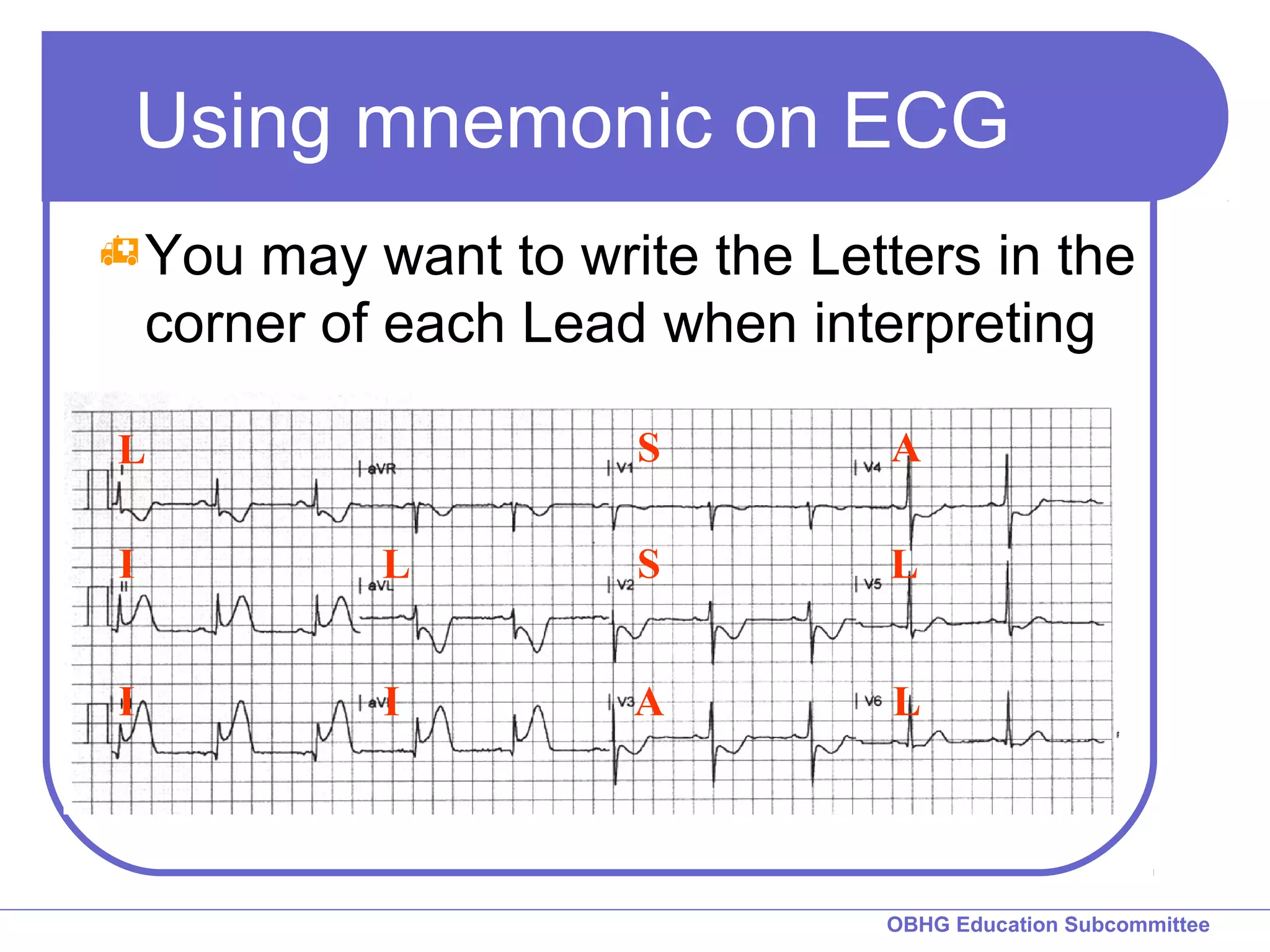 Chapter 6 - Introduction to 12 Lead Interpretation | PPT