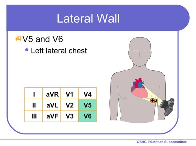 Chapter 6 - Introduction to 12 Lead Interpretation | PPT