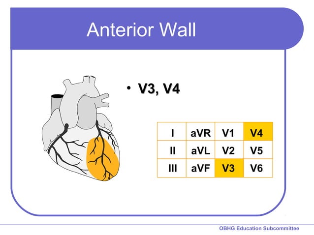 Chapter 6 - Introduction to 12 Lead Interpretation | PPT