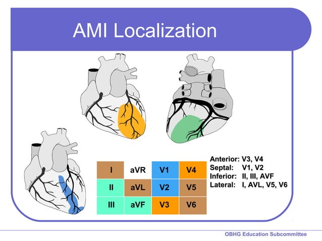 Chapter 6 - Introduction to 12 Lead Interpretation | PPT