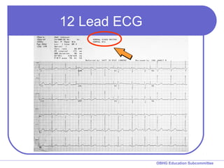 Chapter 6 - Introduction to 12 Lead Interpretation | PPT