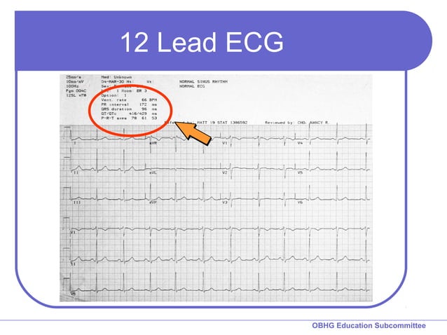Chapter 6 - Introduction to 12 Lead Interpretation | PPT