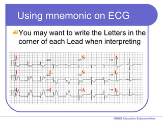 12 Lead Ecg Placement Mnemonic