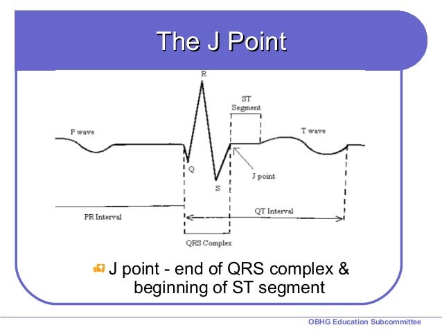 Chapter 6 - Introduction to 12 Lead Interpretation