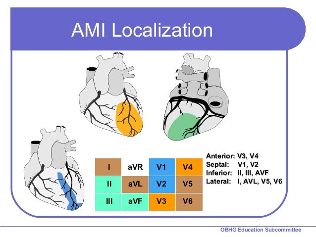 Chapter 6 - Introduction to 12 Lead Interpretation