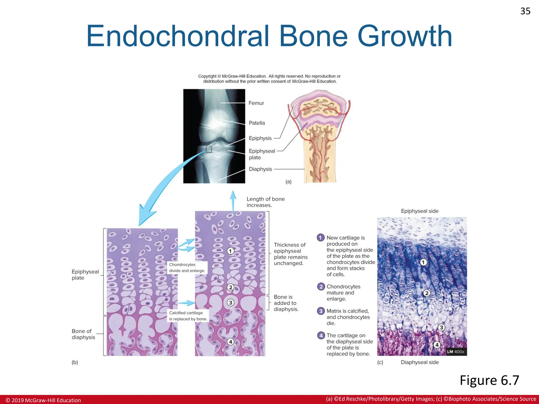 CHAPTER 6 SKELETAL SYSTEM in Anatomy and Physiologypdf | PDF