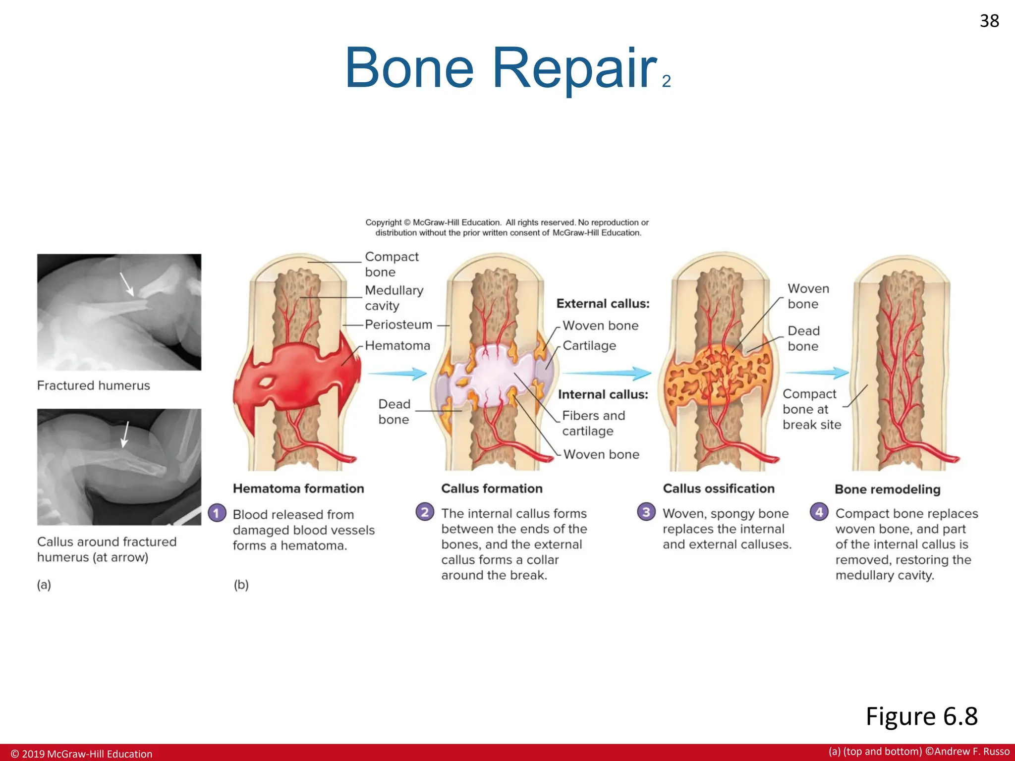 CHAPTER 6 SKELETAL SYSTEM in Anatomy and Physiologypdf | PPT