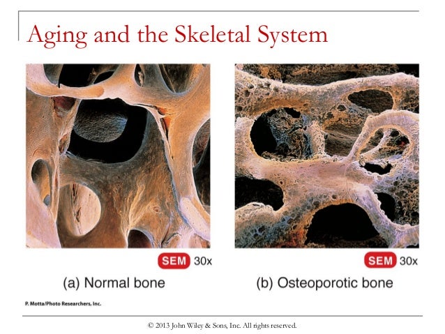 Chapter 6 the skeletal system