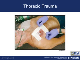Chapter6 thoracic trauma | PPT