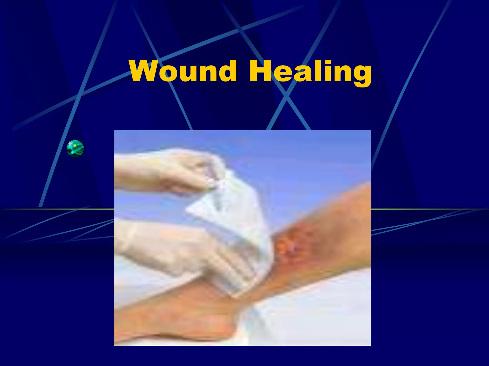 Chapter 6 woundhealing | PPT
