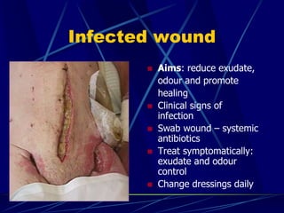 Chapter 6 woundhealing | PPT