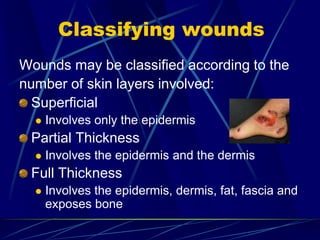 Chapter 6 woundhealing | PPT