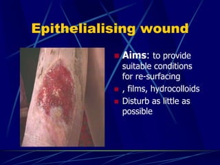 Chapter 6 management and healing woundhealing.ppt