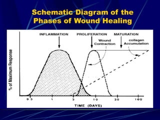 Chapter 6 management and healing woundhealing.ppt