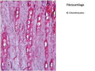 Fibrocartilage Histology Labeled