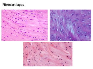 Fibrocartilage Histology Labeled