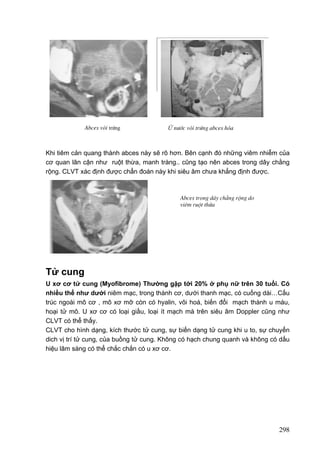 Chapter 7 ct tieu khung - page 296 - 313 | PDF