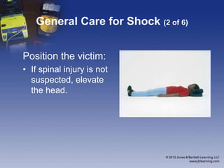 Chapter 7 Shock | PPTX