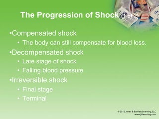 Chapter 7 Shock | PPTX