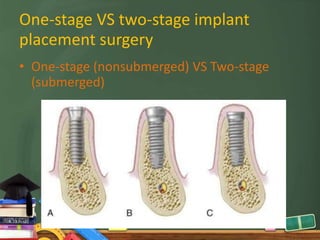 Standard Implant surgical procedure | PPTX