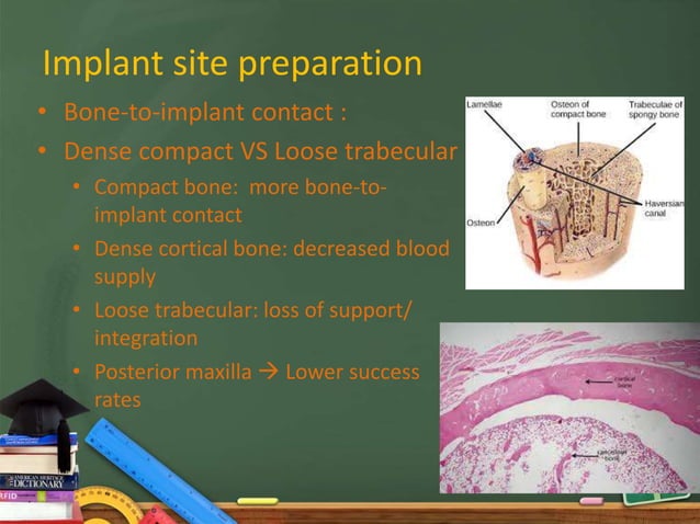 Standard Implant surgical procedure | PPT