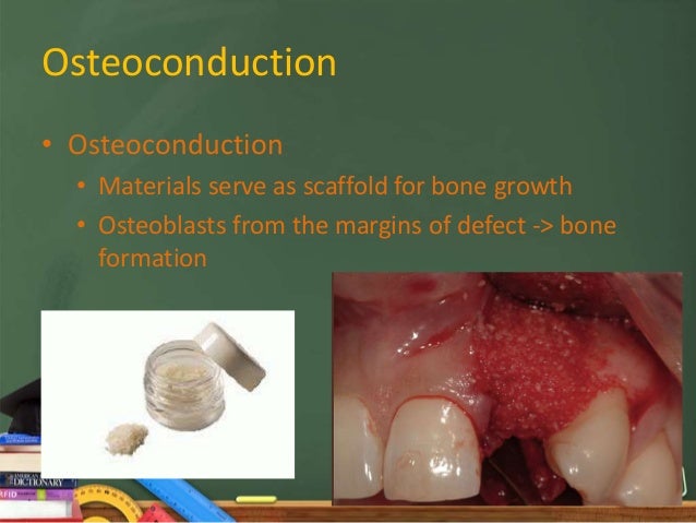Localized bone augmentation and implant site development