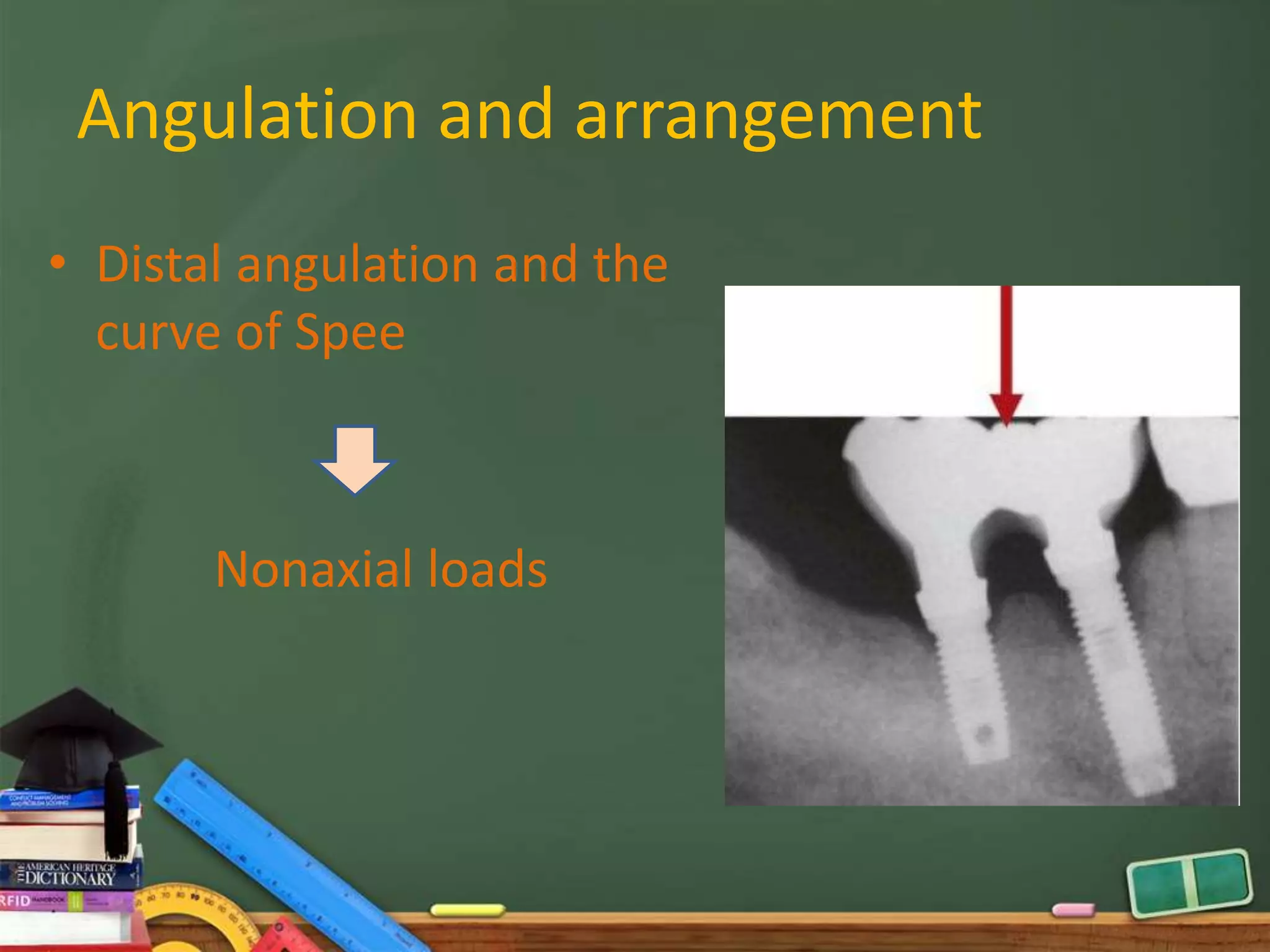 Dental implant biomechanics, treatment planing, and prosthetic ...