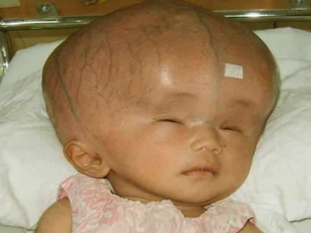 Bioethics Birth Deformities | PDF