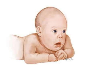 Deformed Babies From Radiation